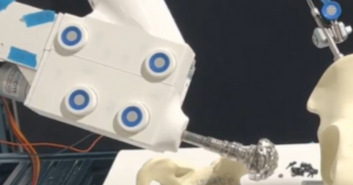 Revolutionizing Total Hip Arthroplasty with Automation | Cobot…